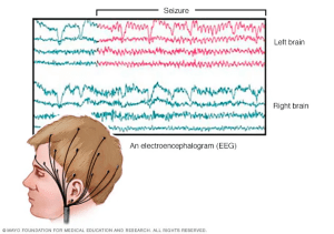 Brain Waves and EEG – Behind the Brain